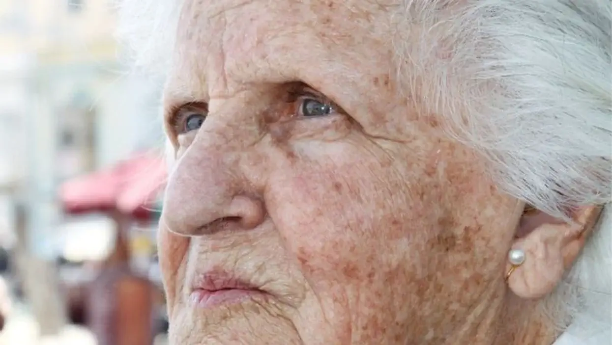 6 Most Common Skin Diseases in the Elderly - Human Health Mag